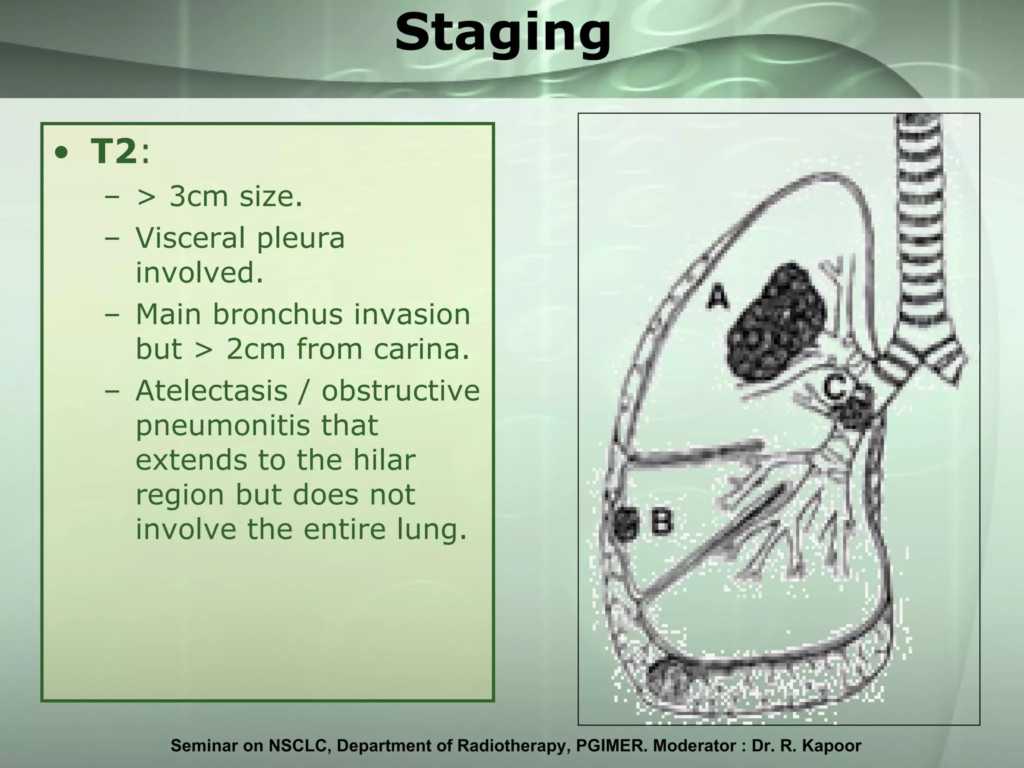 Non Small Cell Lung Cancer | PPT