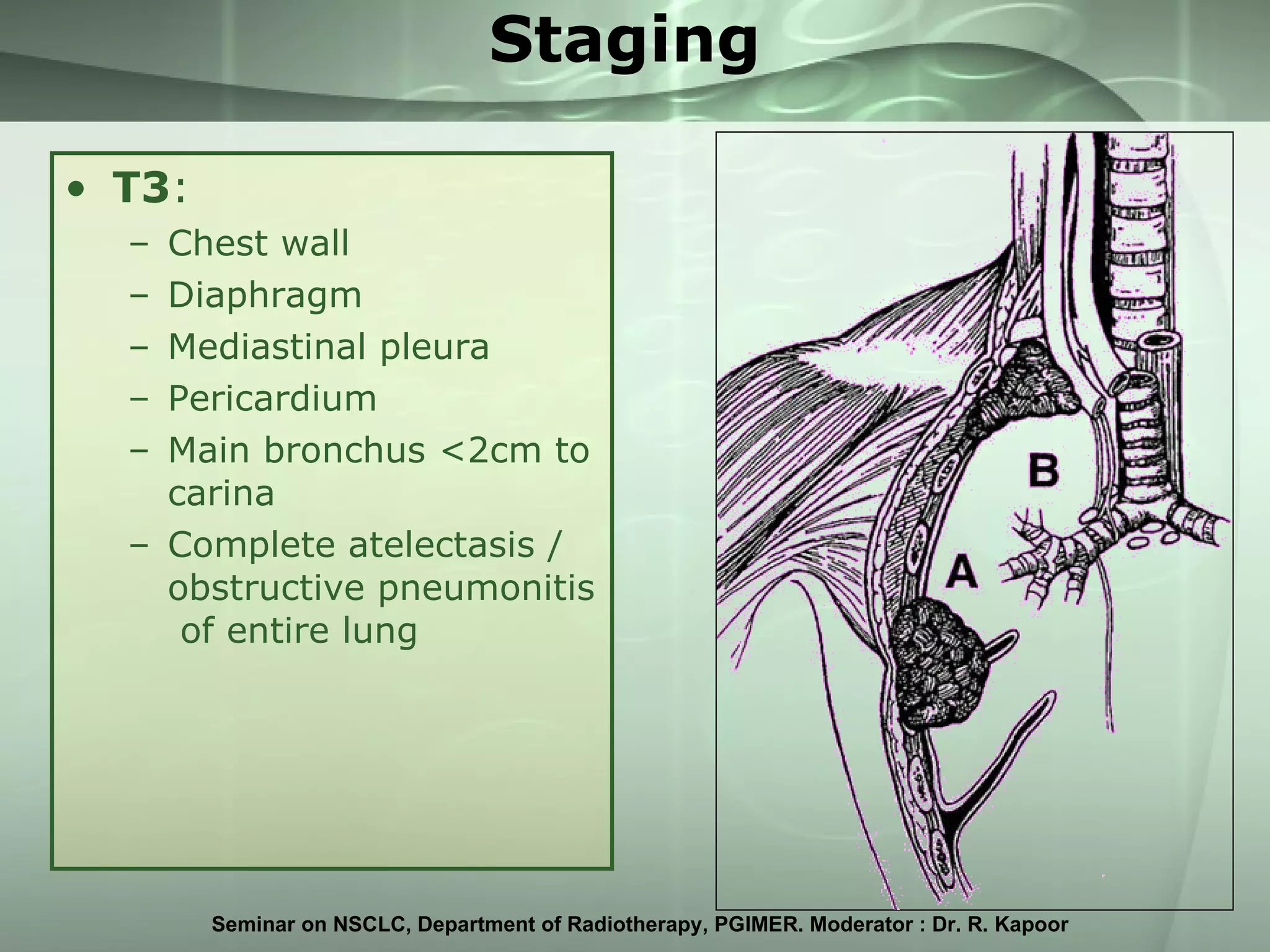 Non Small Cell Lung Cancer | PPT