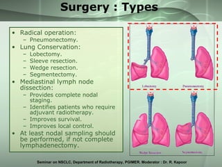 Non Small Cell Lung Cancer | PPT