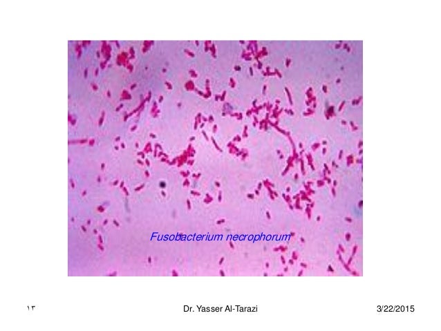 Non spore-forming anaerobic-bacteria2