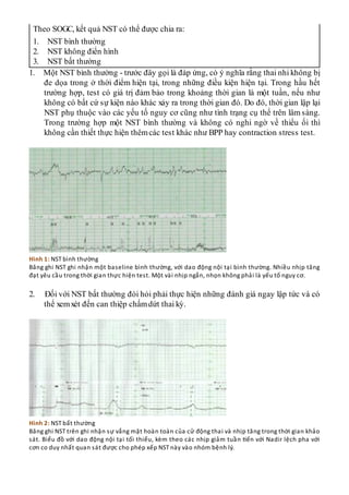 NON STRESS TEST | PDF