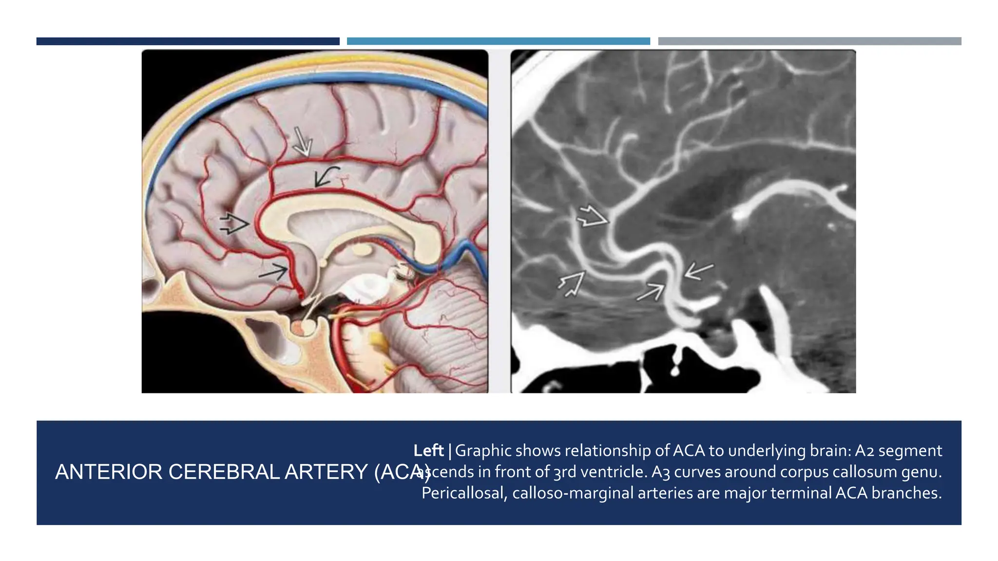 Non-traumatic Vasculogenic Lesions of the Brain | PPTX