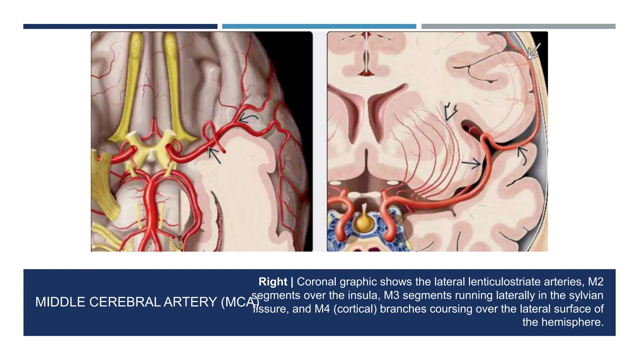 Non-traumatic Vasculogenic Lesions of the Brain | PPTX