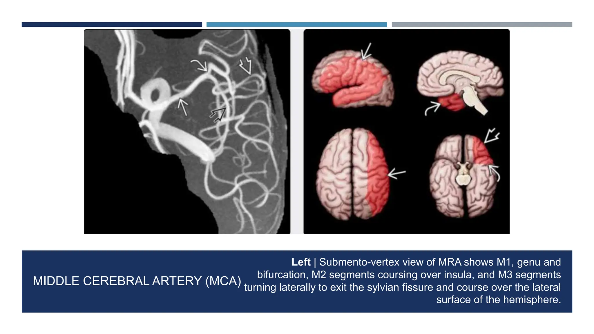 Non-traumatic Vasculogenic Lesions of the Brain | PPTX