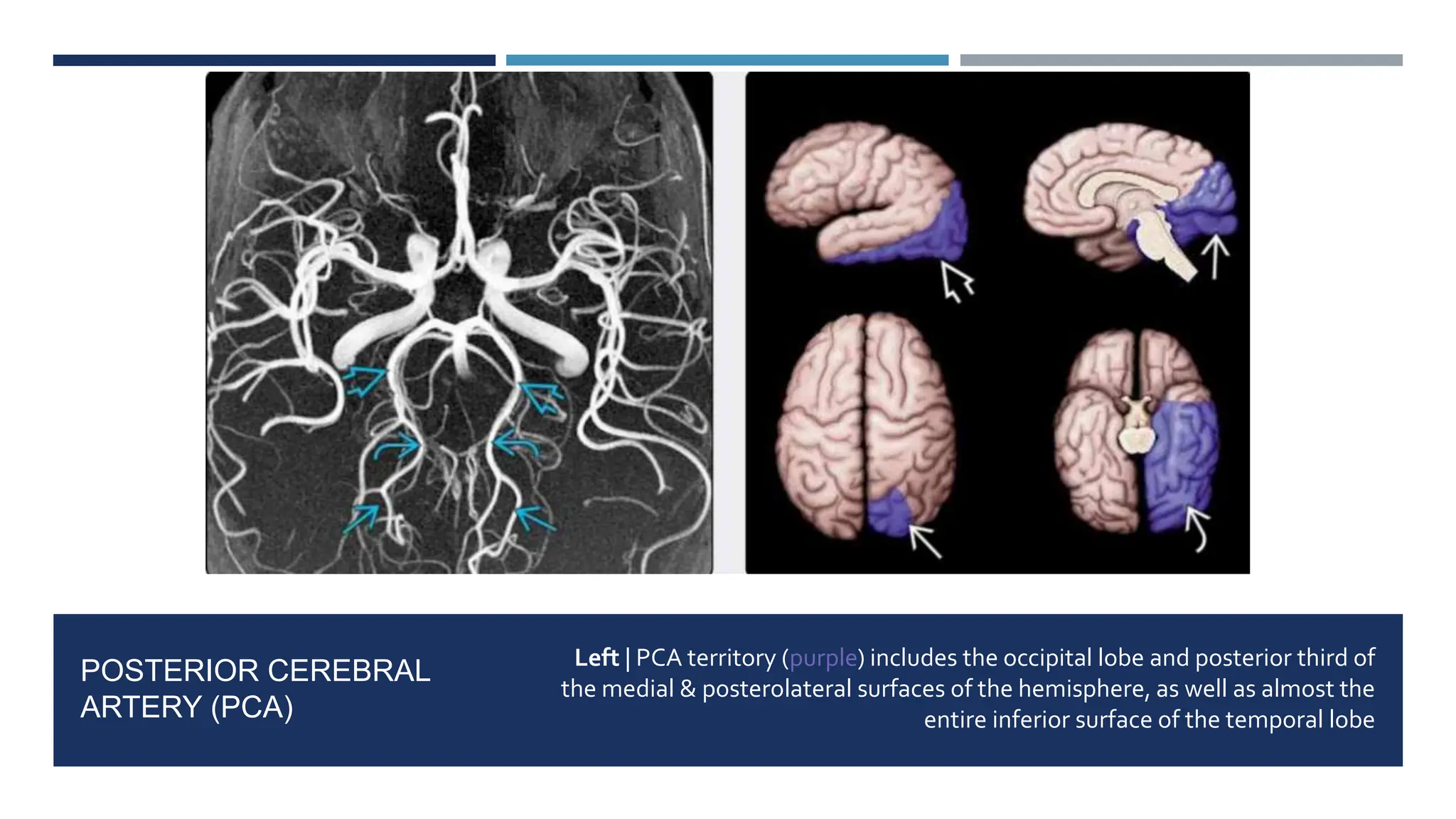 Non-traumatic Vasculogenic Lesions of the Brain | PPTX