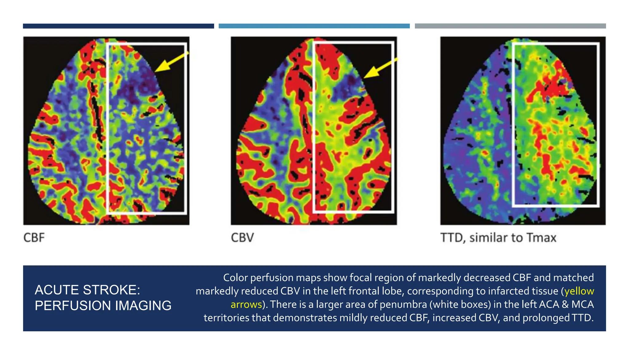 Non-traumatic Vasculogenic Lesions of the Brain | PPTX