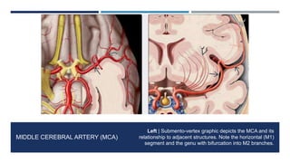 Non-traumatic Vasculogenic Lesions of the Brain | PPTX