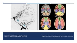 Non-traumatic Vasculogenic Lesions of the Brain | PPTX