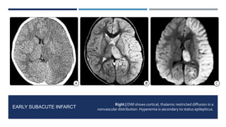 Non-traumatic Vasculogenic Lesions of the Brain | PPTX