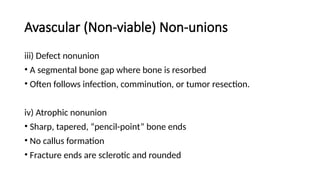 Non-union Femoral Shaft for orthopedics.pptx
