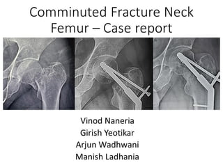 Non-Union of Fracture Neck of Femur.pptx