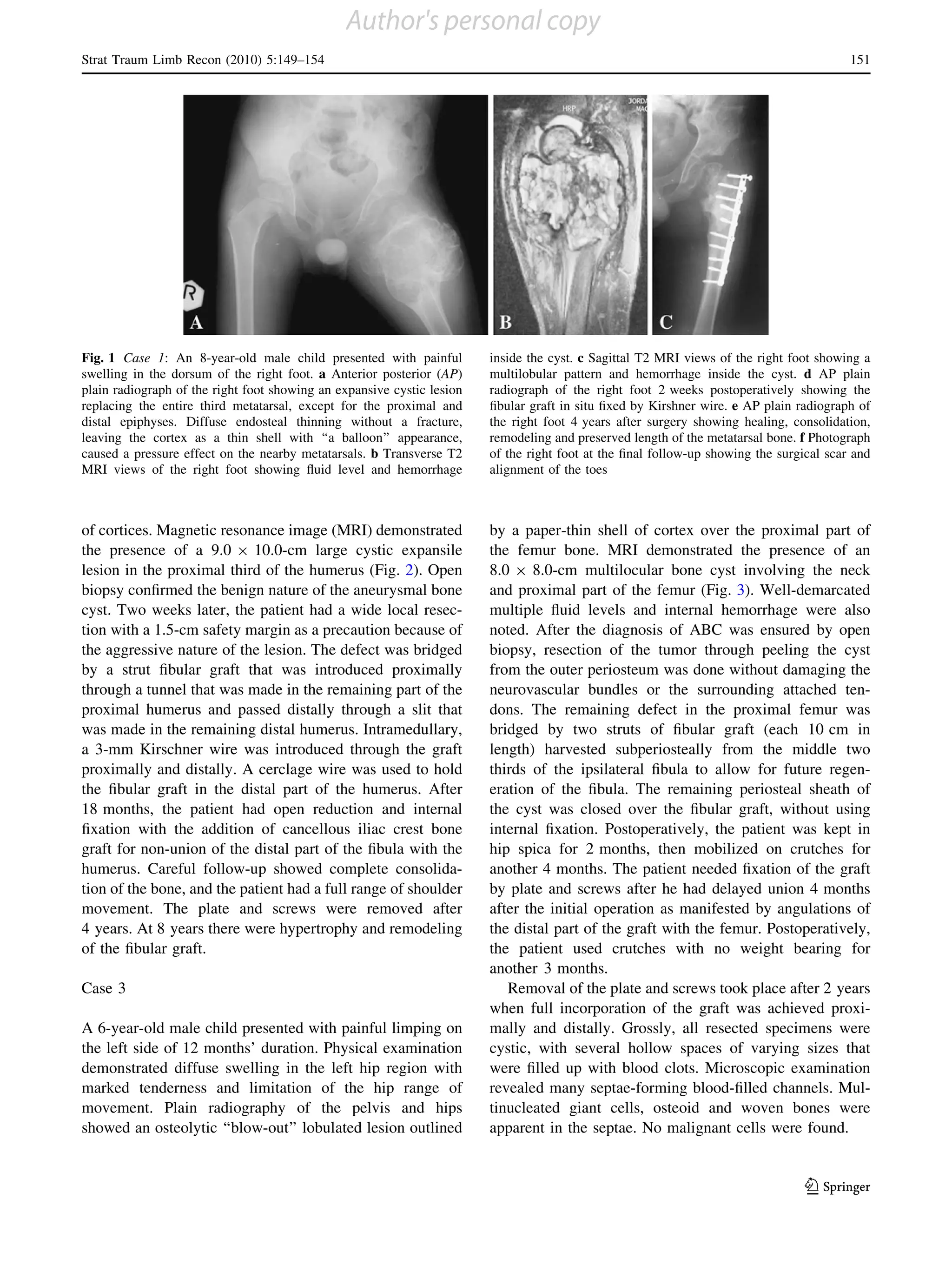 Non-vascularized fibular graft reconstruction after resection.pdf