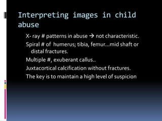 Non accidental injuries | PPTX