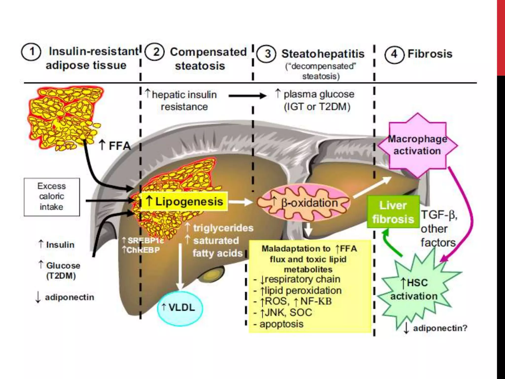 Non-Alcoholic Fatty Liver Disease (NAFLD) | PPTX