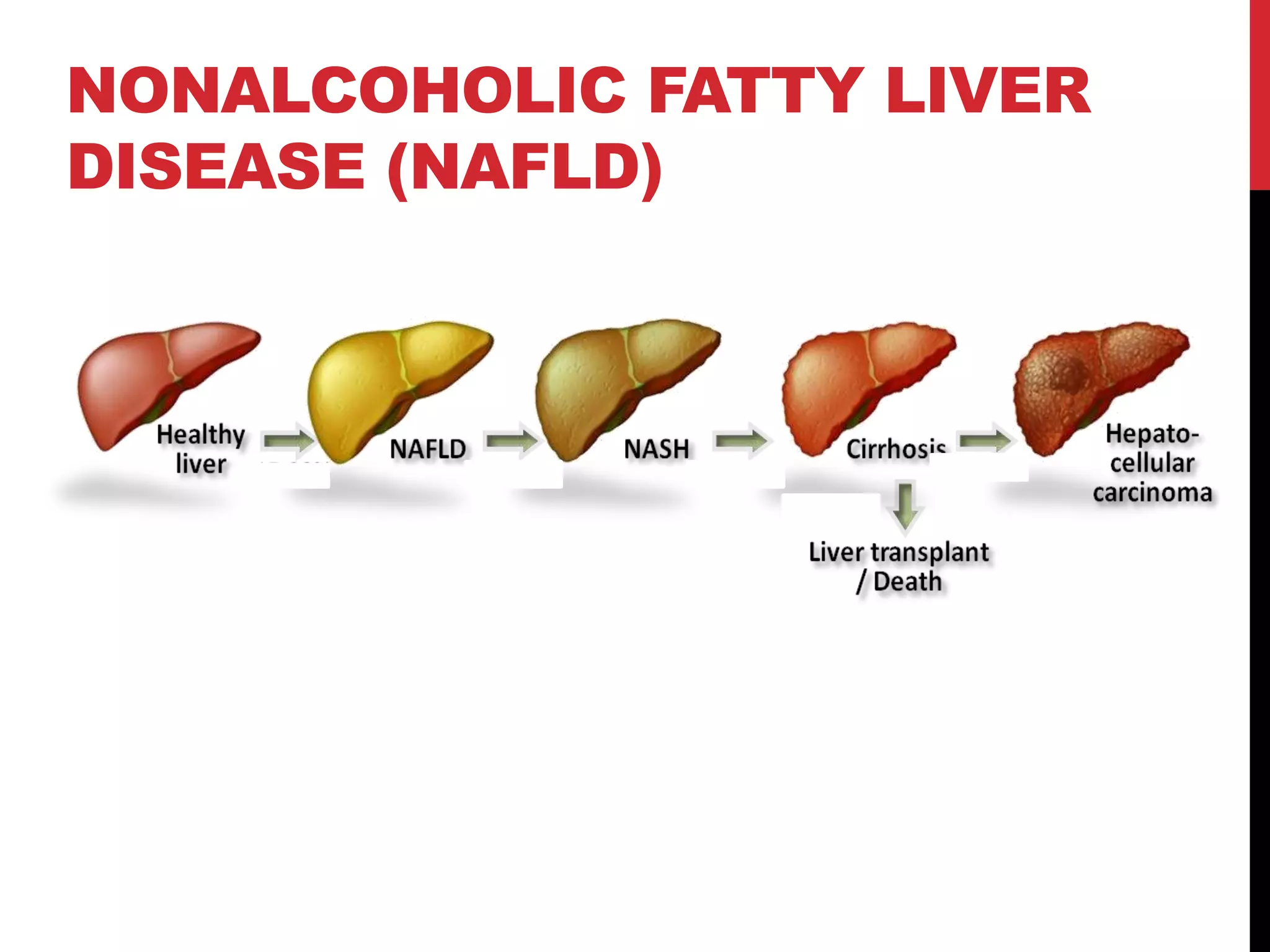 Non-Alcoholic Fatty Liver Disease (NAFLD) | PPTX
