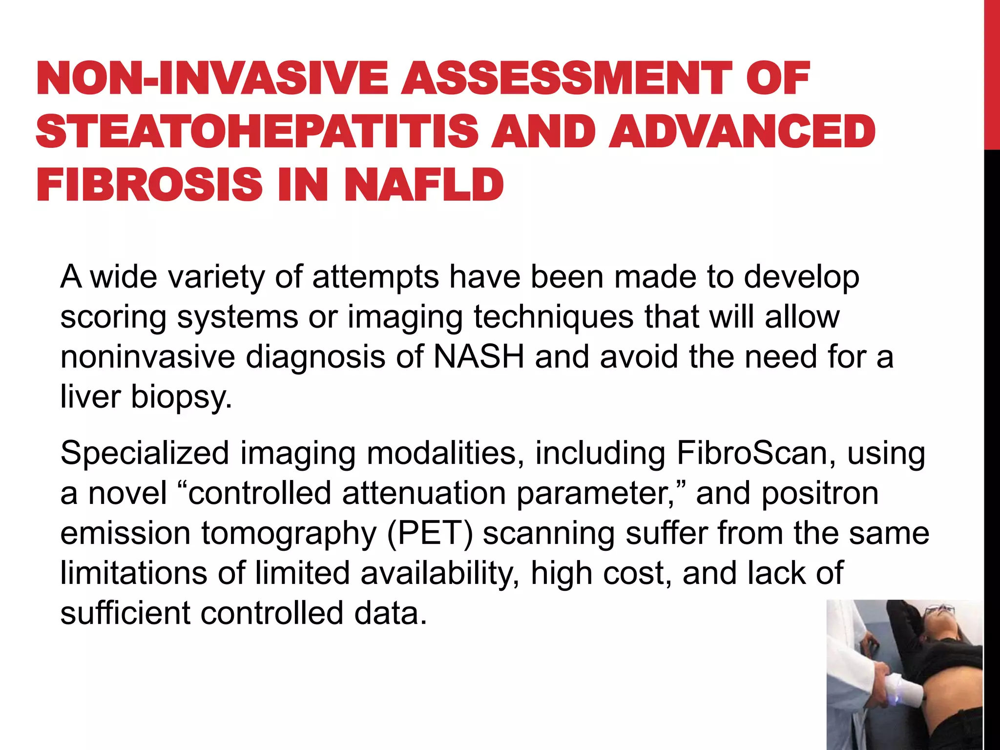 Non-Alcoholic Fatty Liver Disease (NAFLD) | PPTX