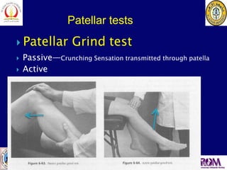 Patellar Grind Test