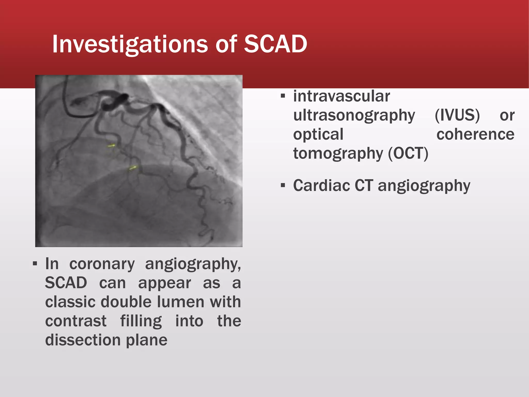 Non Atherosclerotic angina Final Doha Rasheedy.pptx