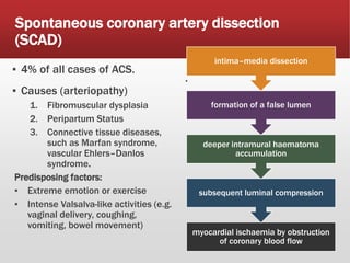 Non Atherosclerotic angina Final Doha Rasheedy.pptx