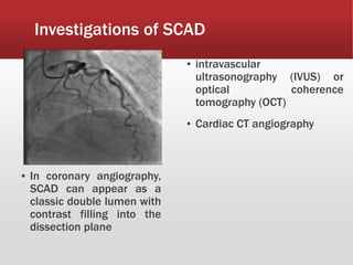 Non Atherosclerotic angina Final Doha Rasheedy.pptx