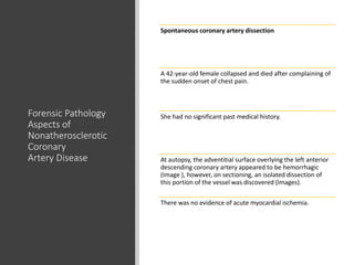 Forensic Pathology Aspects of Nonatherosclerotic Coronary Artery ...