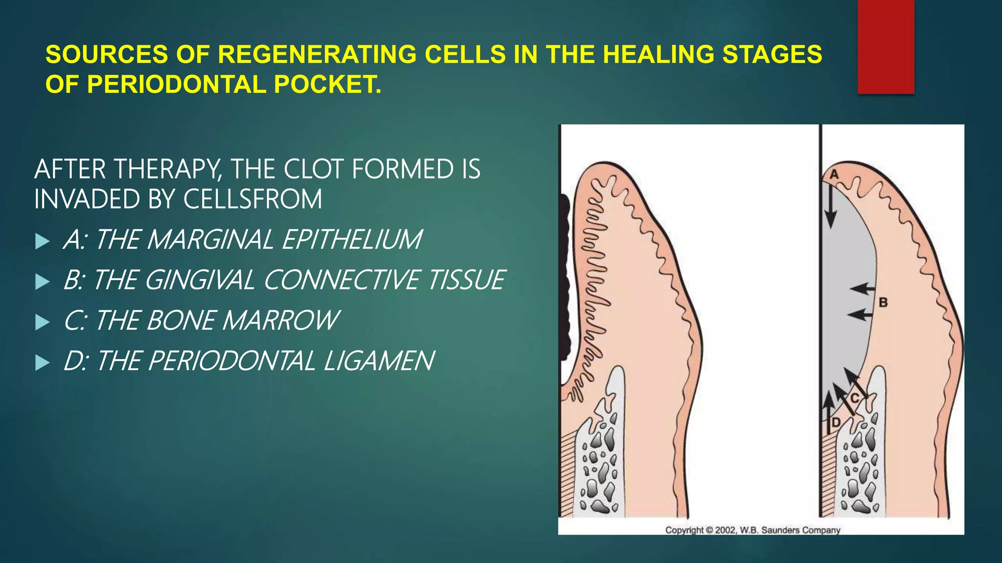 Non bonegraft associated regeneration. Dr. kinjal ghelani | PPTX