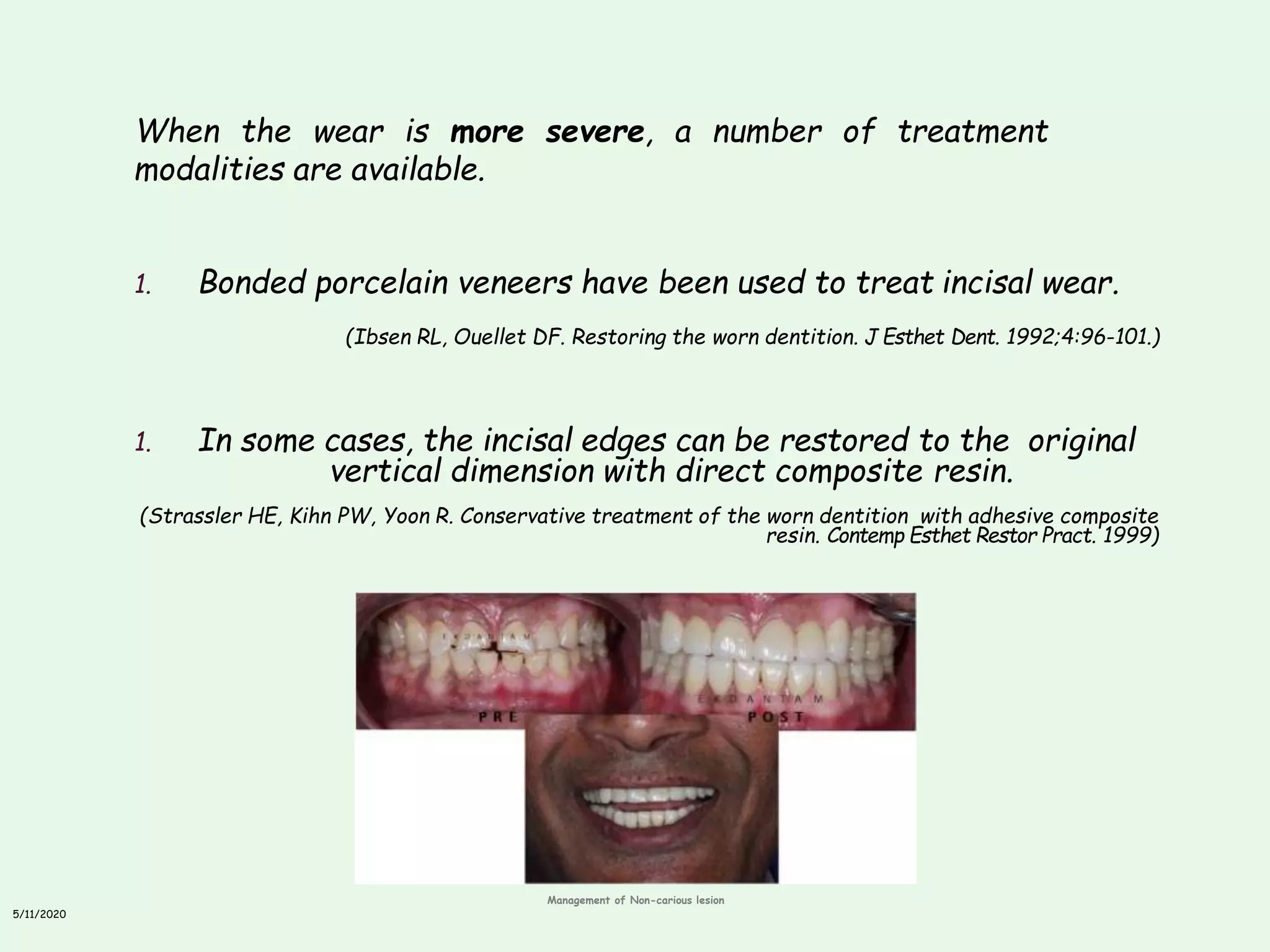 Non carious tooth lesions | PPTX