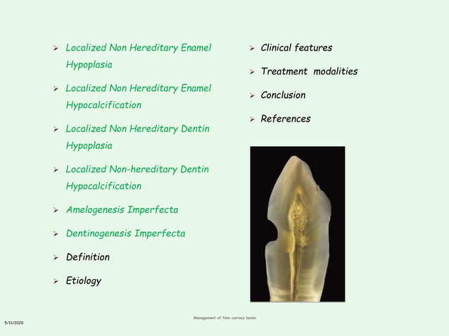 Non carious tooth lesions | PPTX