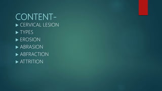 NON CARIOUS TOOTH SURFACE LOSS | PPTX