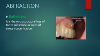 NON CARIOUS TOOTH SURFACE LOSS | PPTX