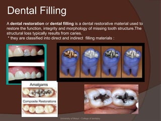 Non colored filling material | PPT