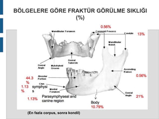 mandibula frakturleri | PPT