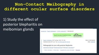 Noncontact Meibography.pptx