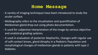 Noncontact Meibography.pptx