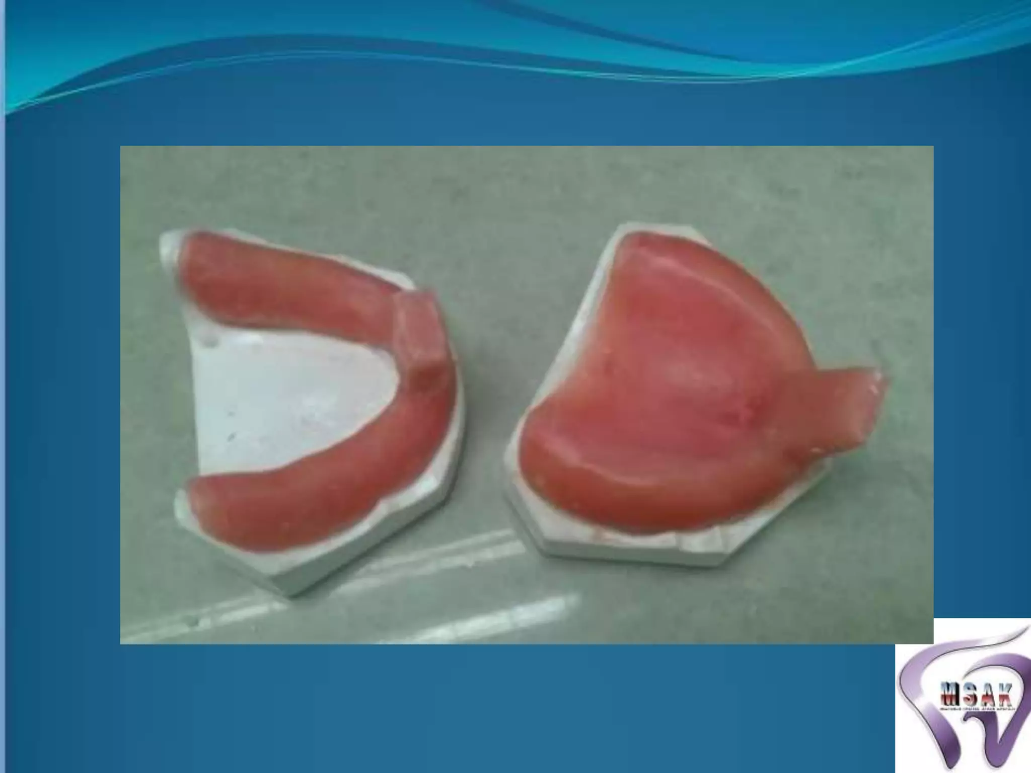 Non elastic/ rigid impression materials | PPTX