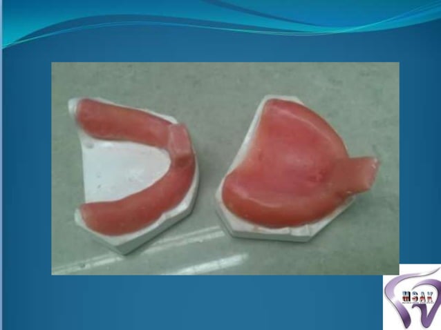 Non elastic/ rigid impression materials | PPTX
