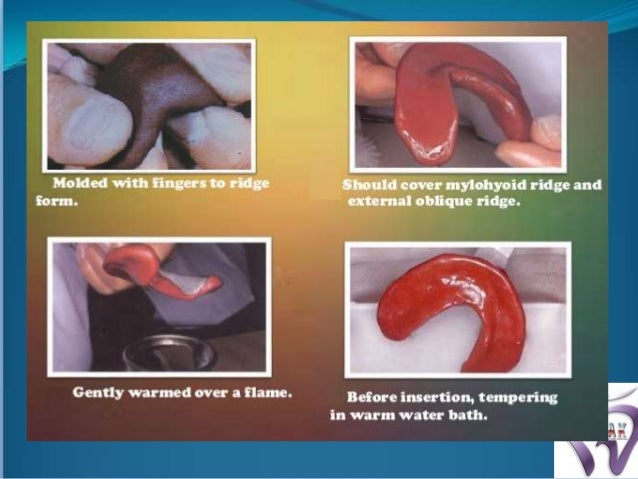 Non elastic/ rigid impression materials