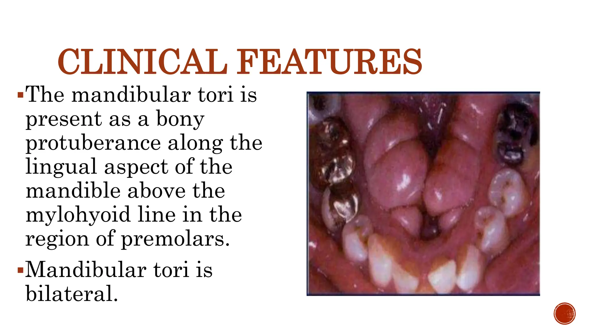Non epithelial neoplasms.pptx oral pathology | PPTX