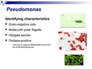 non fermentative gram negative bacteria.ppt