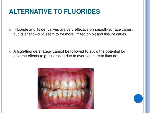 Non Fluoride Enamel Remineralization