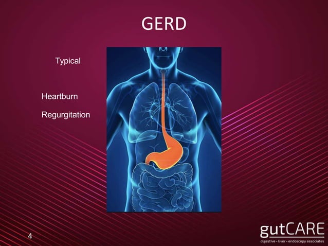 NON GI PRESENTATION OF GI DISORDER | PPT