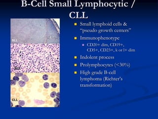 Non hodgkin lymphoma | PPTX