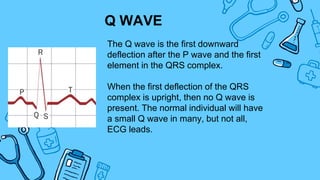 Non infarction Q waves | PPTX