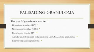 NON INFECTIOUS GRANULOMA PRESENTATION.pptx