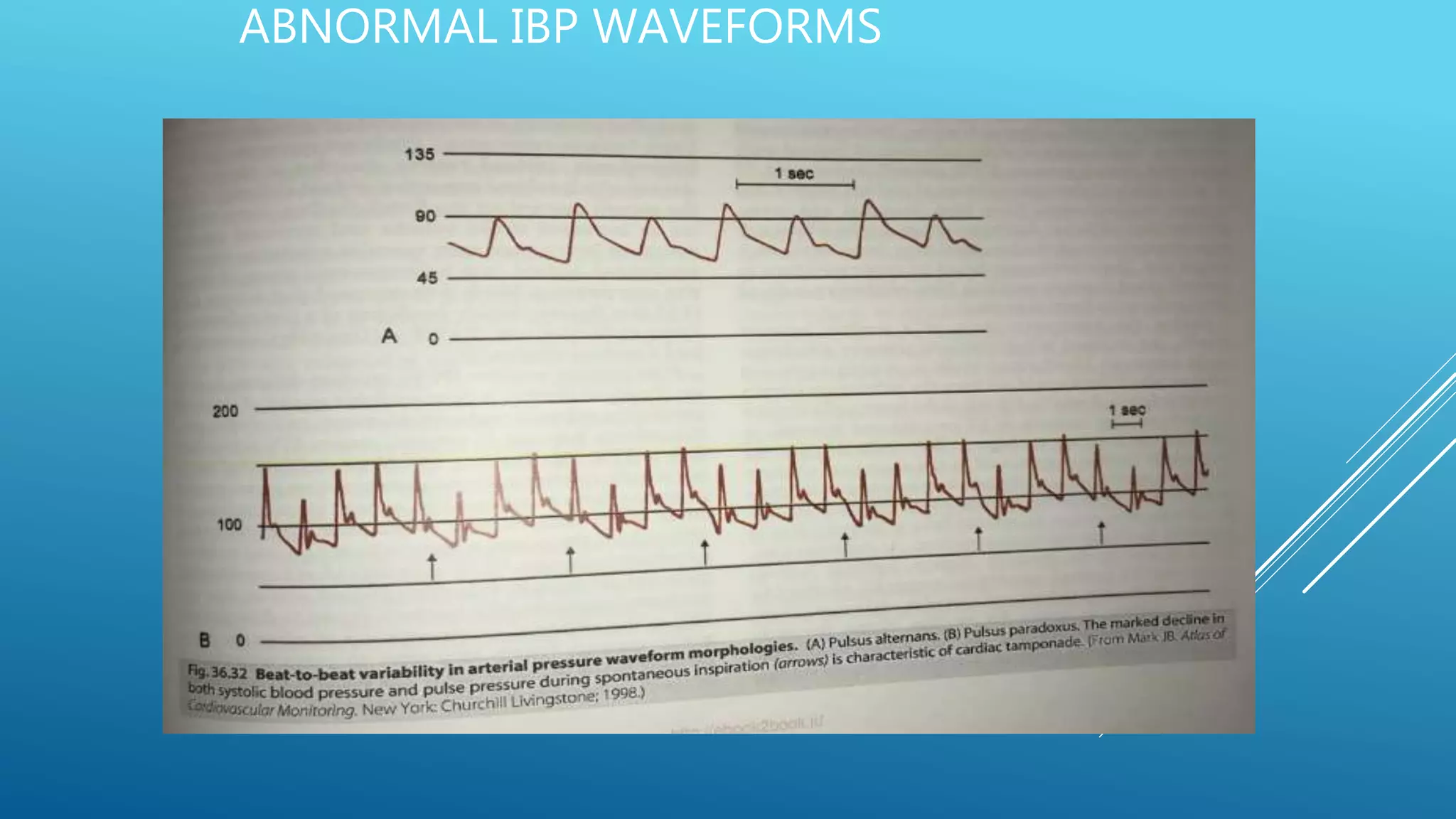 Non invasive and_invasive_bp_monitoring__copy | PPTX