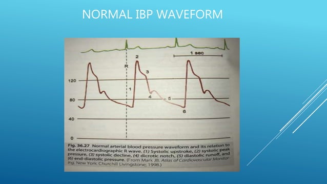 Non invasive and_invasive_bp_monitoring__copy | PPTX | Heart and ...