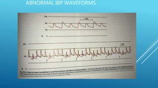 Non invasive and_invasive_bp_monitoring__copy | PPTX