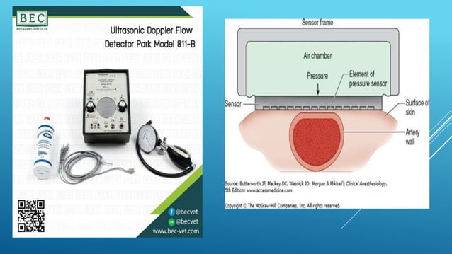 Non invasive and_invasive_bp_monitoring__copy | PPTX | Heart and ...
