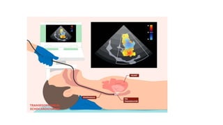 non invasive and invasive cardiac monitoring.pptx