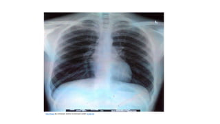 non invasive and invasive cardiac monitoring.pptx